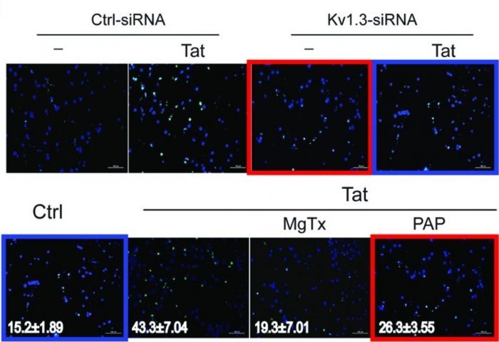Detecting Image Manipulation in Biological Research – Enago